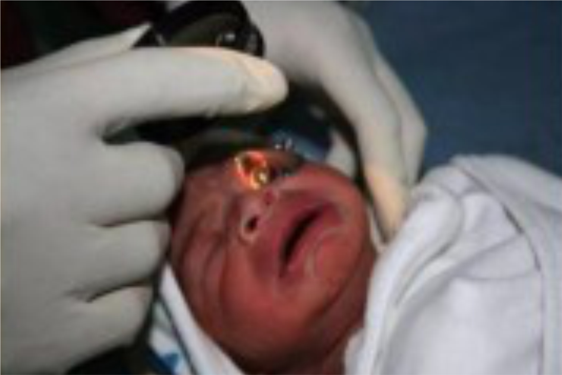 Retinopathy of Prematurity (ROP) Clinic - COAVS